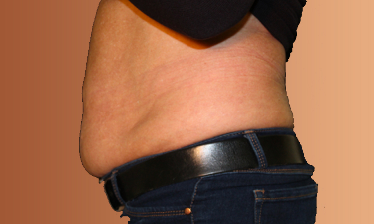 Elegant Hoopoe Health and Aesthetics | Jumeirah, Dubai