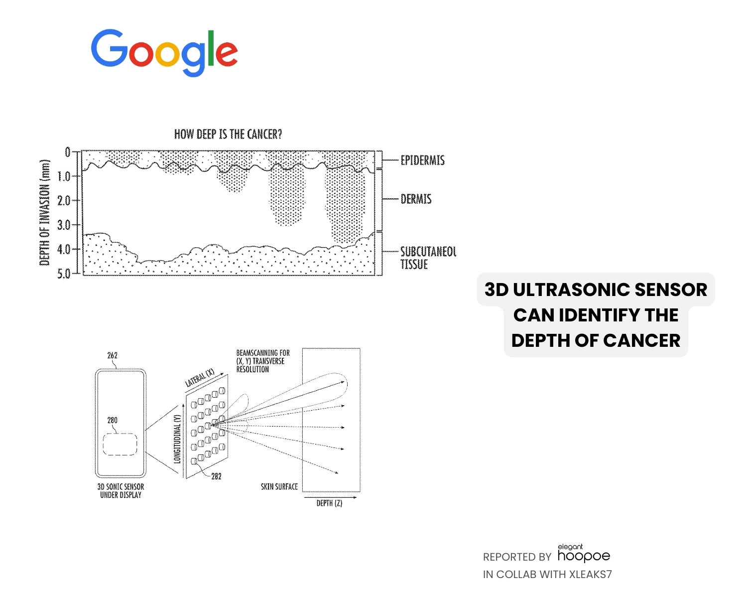 Google Skin Cancer Diagnostic Tool: Smartphone as Your Lifesaver ...